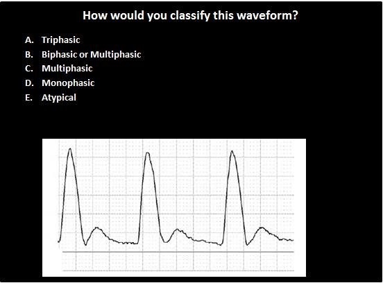 How Would You Describe This Doppler Waveform Part 1